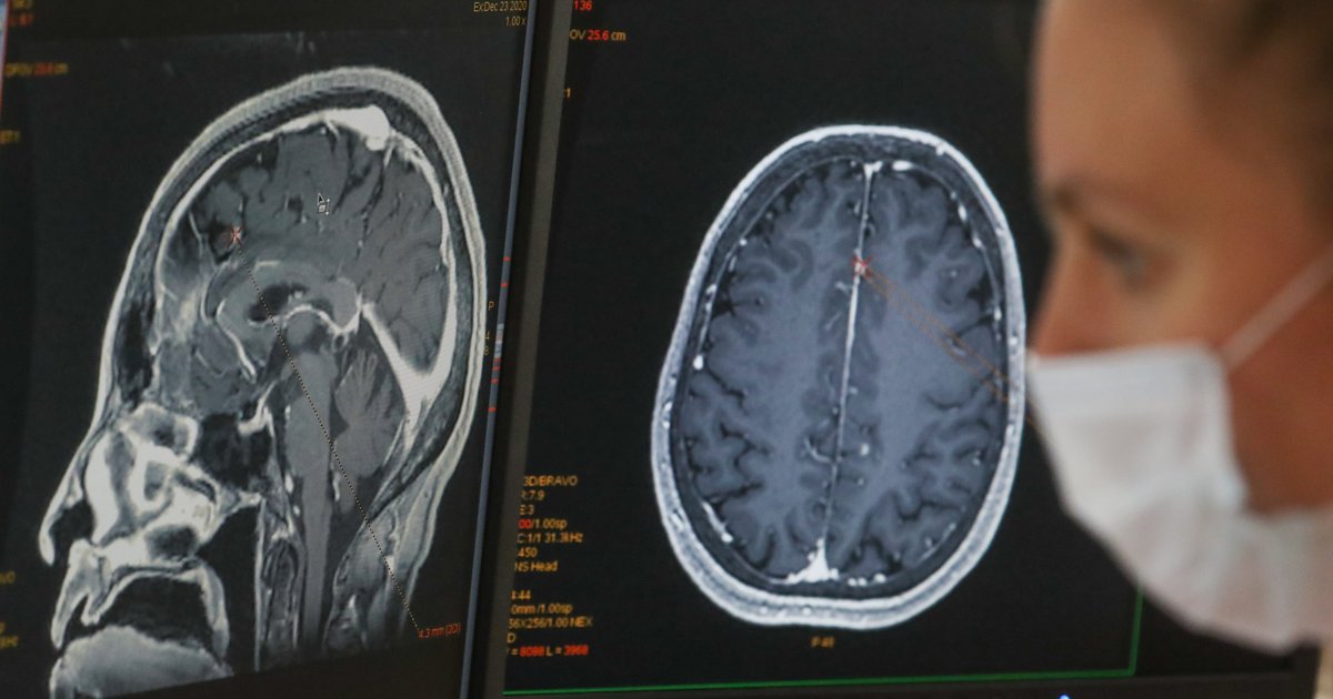 Even mild sports-related brain injuries can lead to persistent health ...