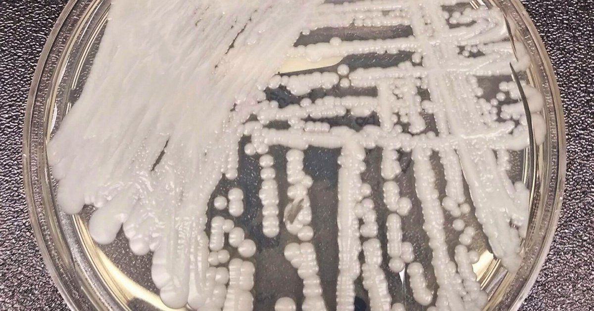 What is C. auris? How the drug-resistant fungal infection spreads and ...