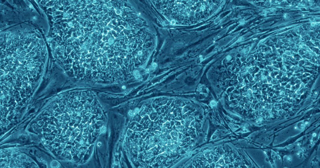 New Jersey is about to legalize marijuana. Our own stem cells should be ...