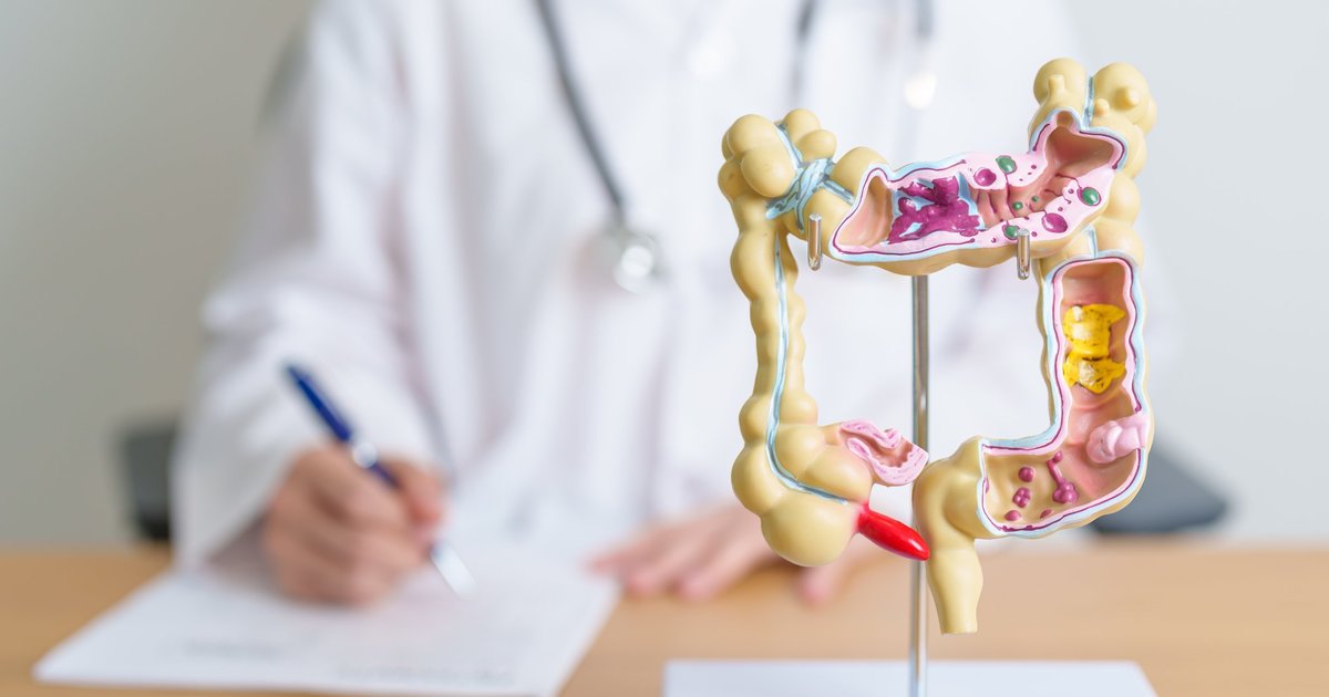 New colorectal cancer screening guidelines: American Cancer Society ...