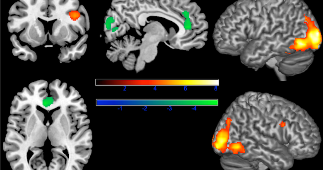 We have a subconscious negative brain response to disfigured faces ...
