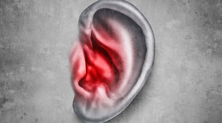 Tinnitus | PhillyVoice