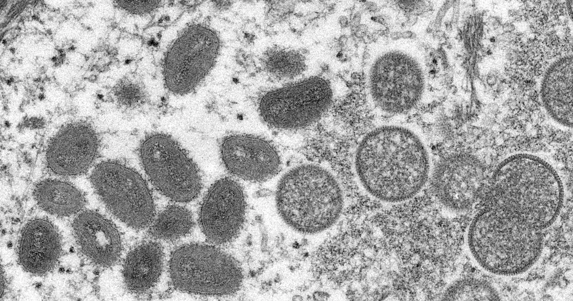 How does monkeypox spread? The virus uses close physical contact – not ...
