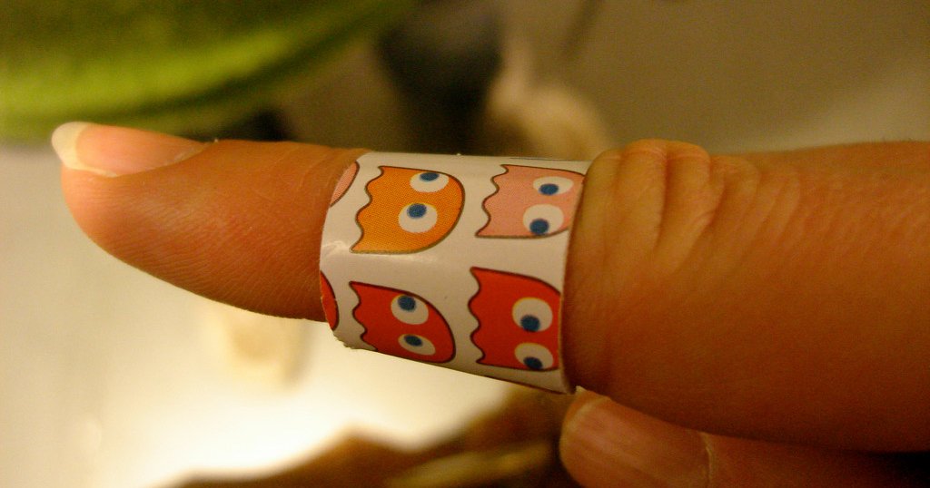 Why do paper cuts hurt so much? | PhillyVoice