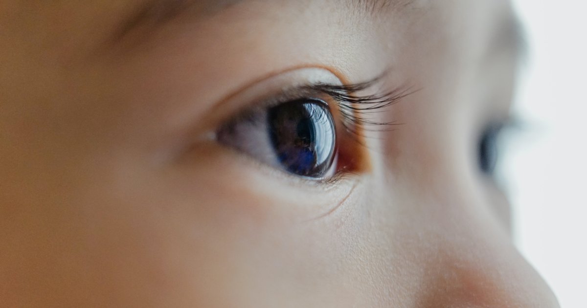 Many childhood blindness cases are caused by treatable conditions ...