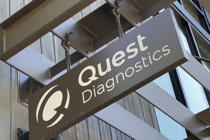 New Alzheimer’s blood test has clinicians doubtful of its efficacy ...