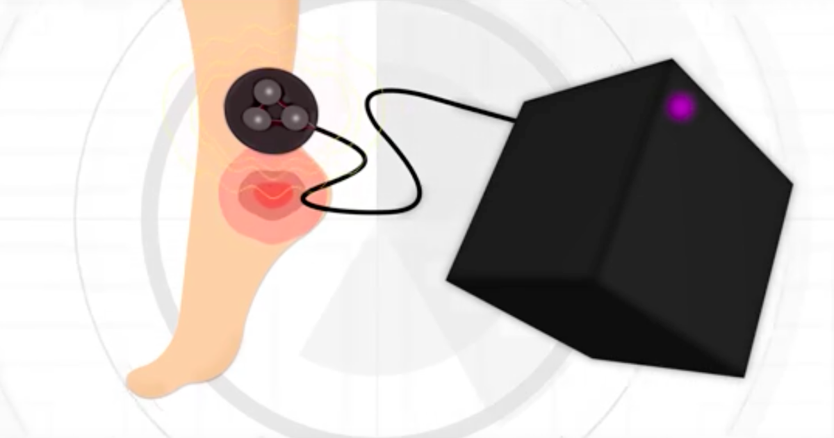 Drexel researchers awarded $3 million to test innovative gadget that ...