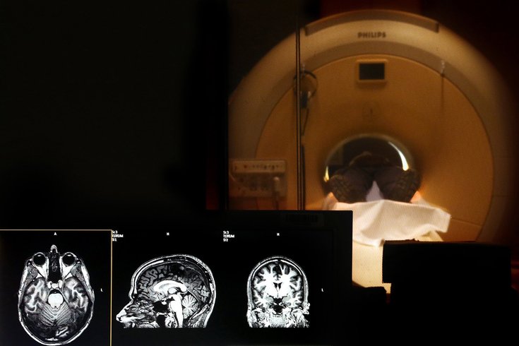 Temple scientist developing blood test to better diagnose traumatic ...