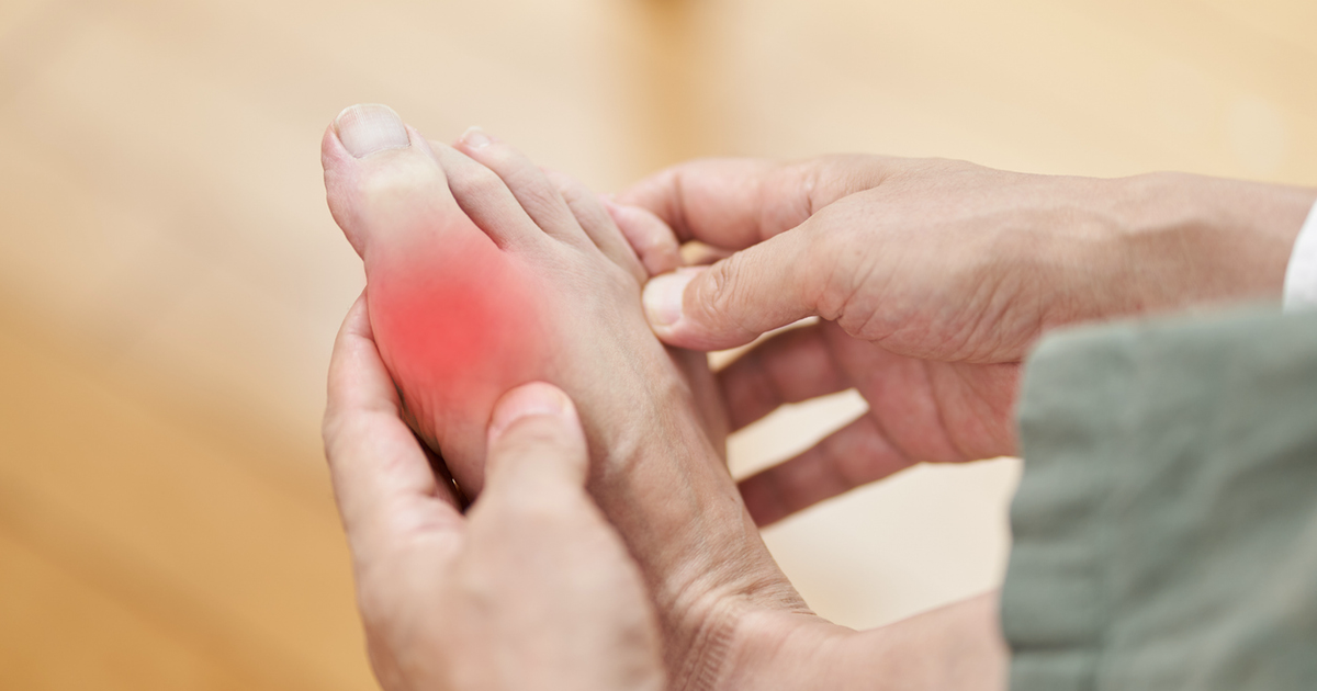 Gout is a serious and often misunderstood health condition | PhillyVoice