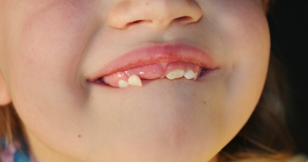 Tooth-fairy customs from across the globe | PhillyVoice